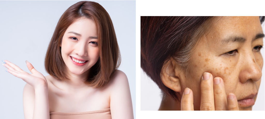 "What the Skin Wants to Tell You" How to Maintain Our Skin (1) - 愿景中医 ...