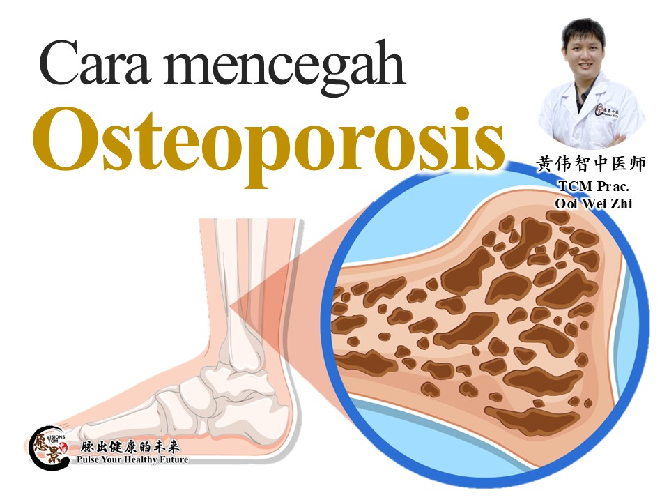 Bagaimana mencegah osteoporosis? - 愿景中医 Visions TCM